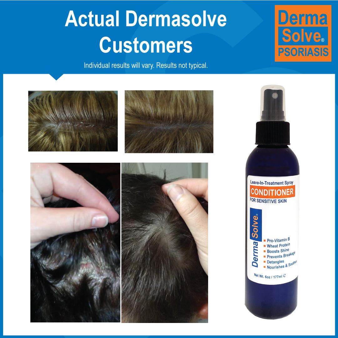 Dermasolve Leave-In Detangler Spray Conditioner